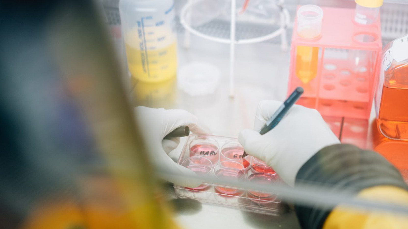 Virologie in Marburg - 3 – Hessen schafft Wissen